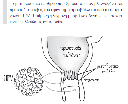 Καρκίνος Πρωκτού και HPV | Δρ. Μορτάκης