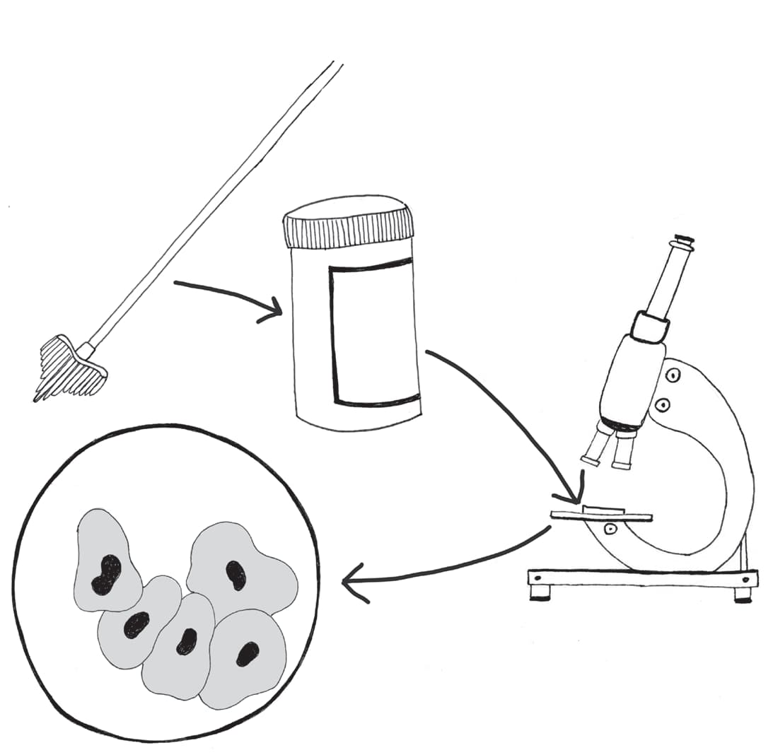 How is the Pap test performed? - MORTAKIS CLINIC