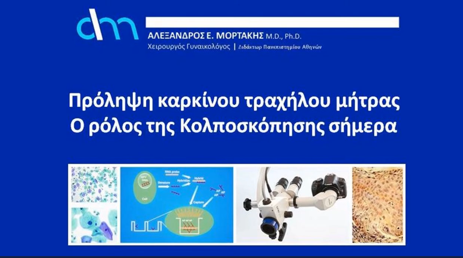 9. Κολποσκόπηση στην πρόληψη Ca Τραχήλου Μήτρας - MORTAKIS CLINIC